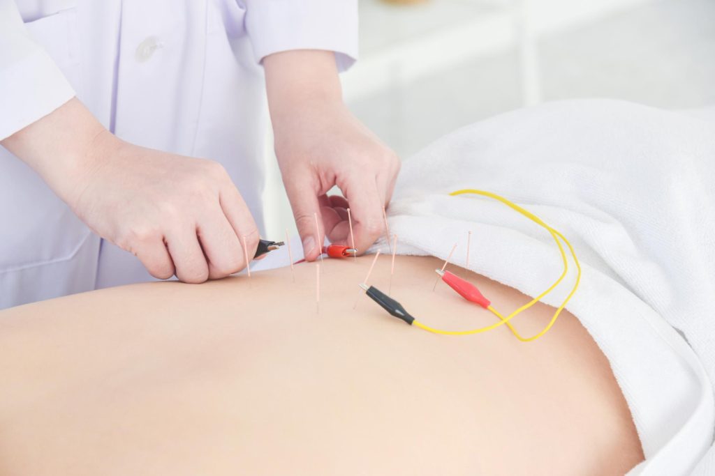 Electrical Acupuncture Benefits for Nerve Signaling Health